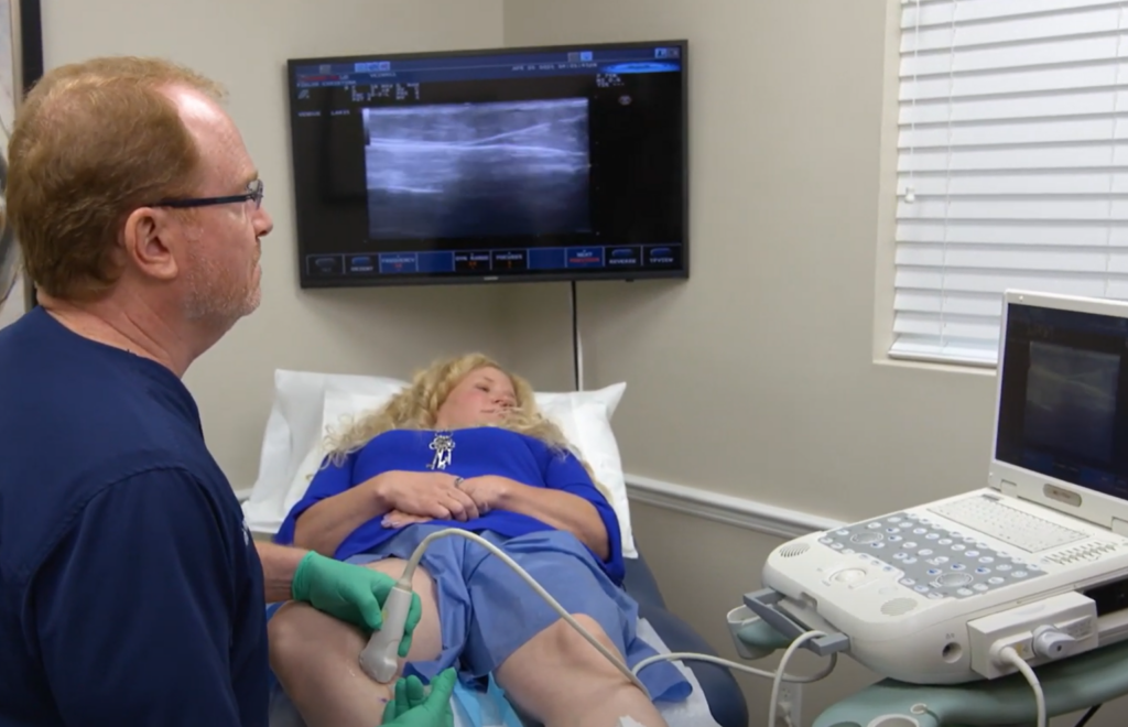 Varicose Vein Treatment Tampa FL - Varicose Veins Removal Expert