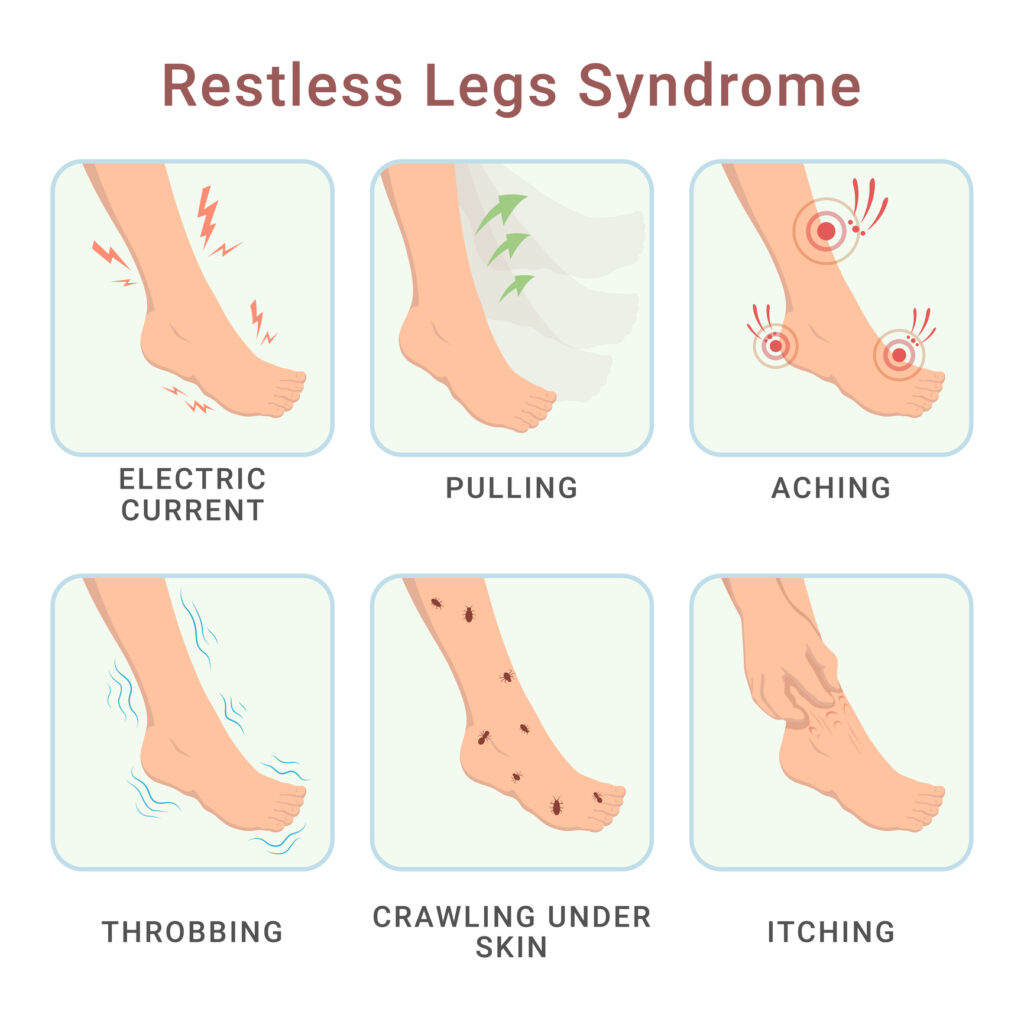 Restless Leg Syndrome Treatment Tampa FL - RLS Specialist