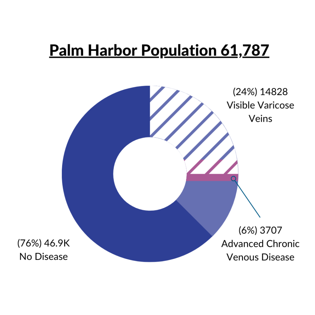 Best Palm Harbor Varicose Vein Specialist | Vein911
