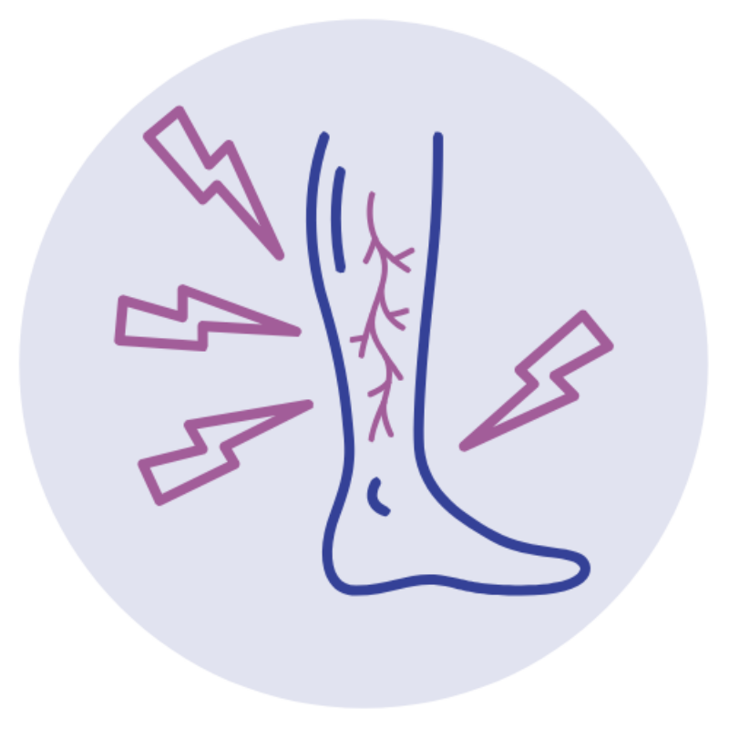 Best Varicose Vein Specialist Tampa FL - Vein Treatment Centers